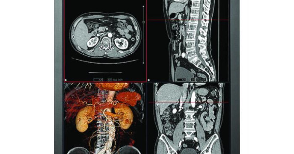 Медицински монитор EIZO RadiForce RX250 2MP Цветен
